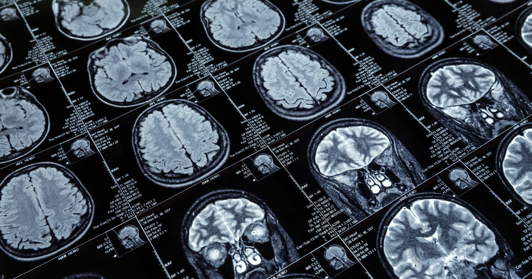 Pacs on web — Clinique Saint-Pierre Ottignies